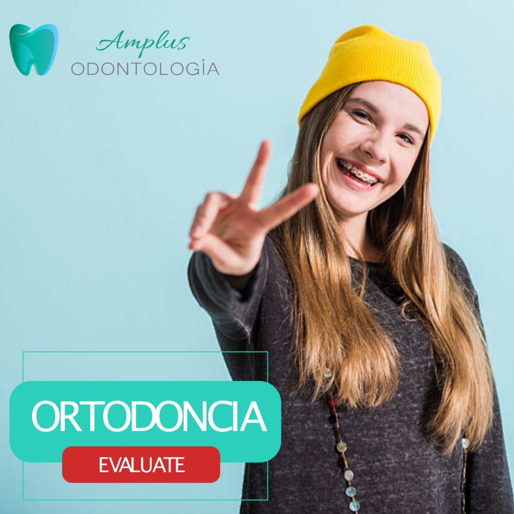 Alinear dientes – Clínica Dental Amplus
